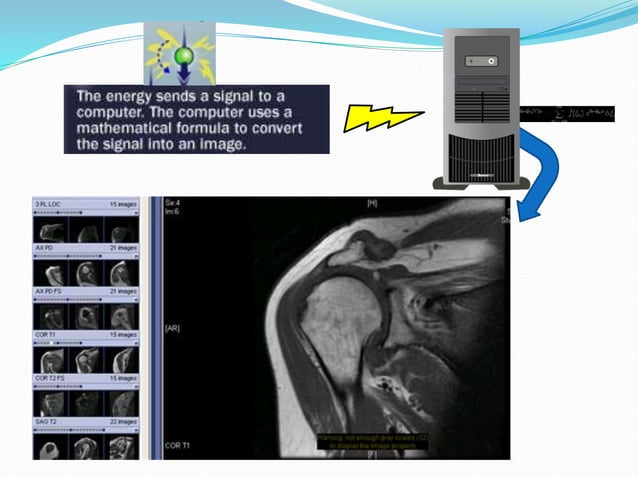 Introduction to mri | PPTX