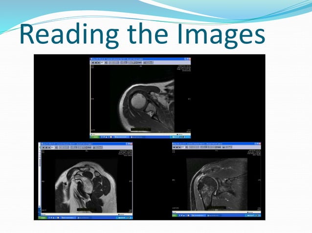 Introduction to mri | PPTX