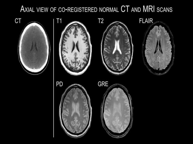 Introduction to mri | PPTX