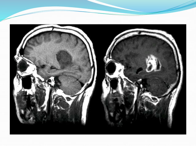Introduction to mri | PPTX
