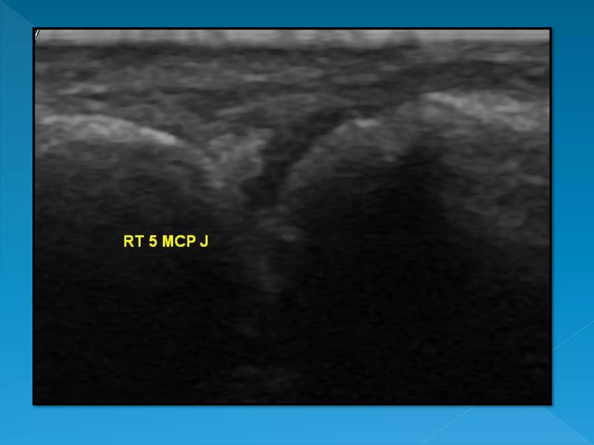 Introduction to msk us normal appearance pdf | PDF