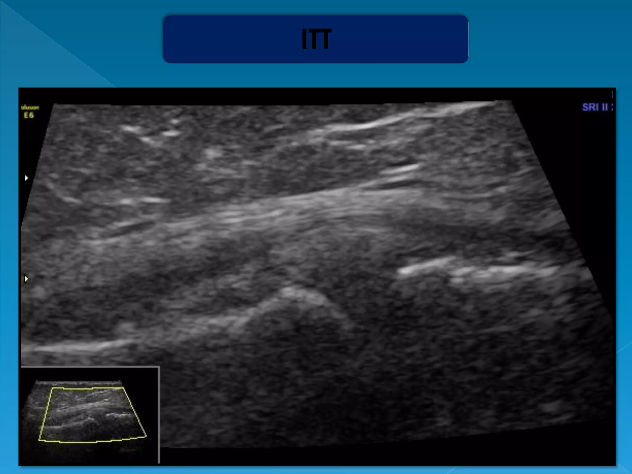 Introduction to msk us normal appearance pdf | PDF