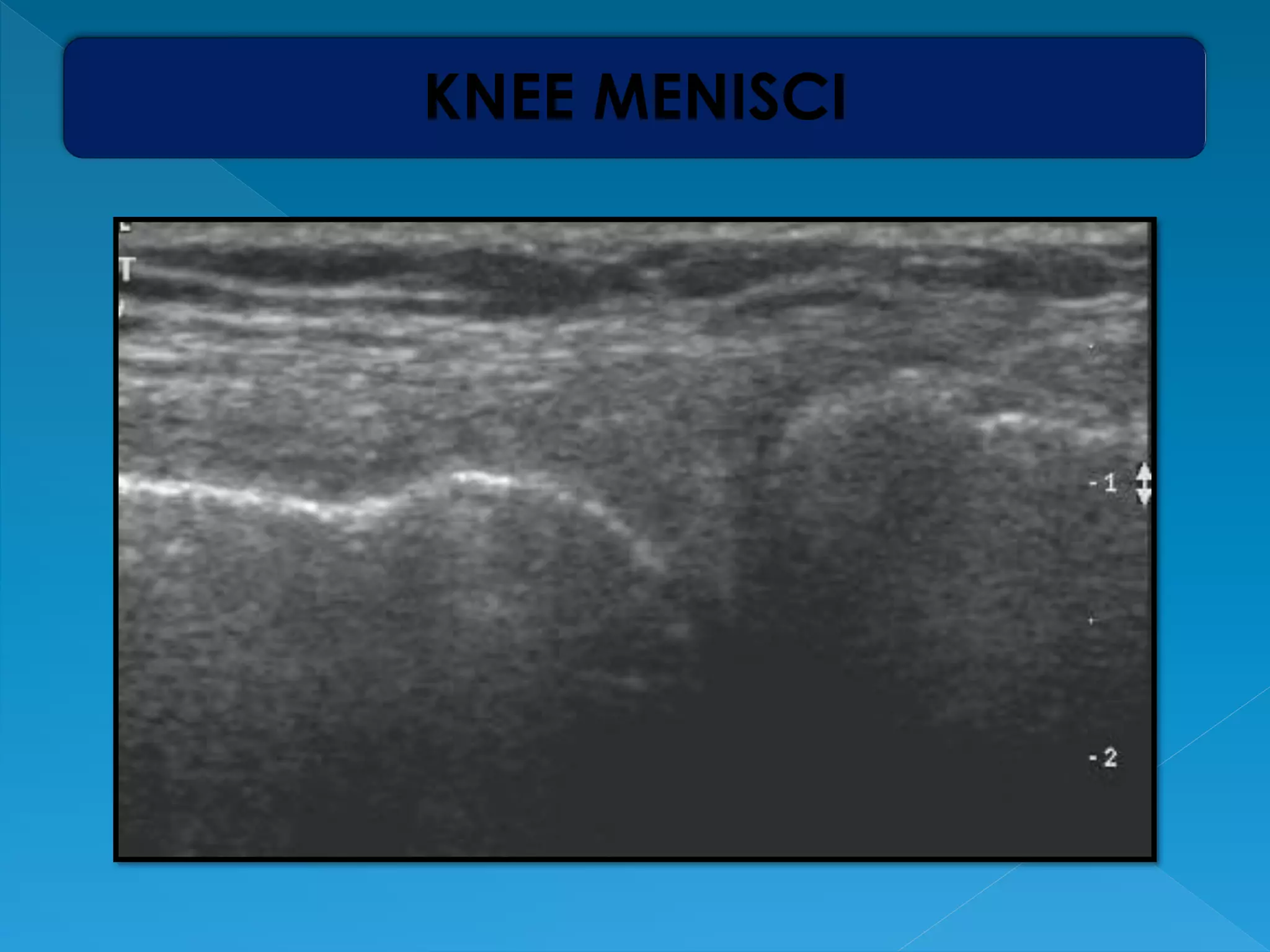 Introduction to msk us normal appearance pdf | PDF
