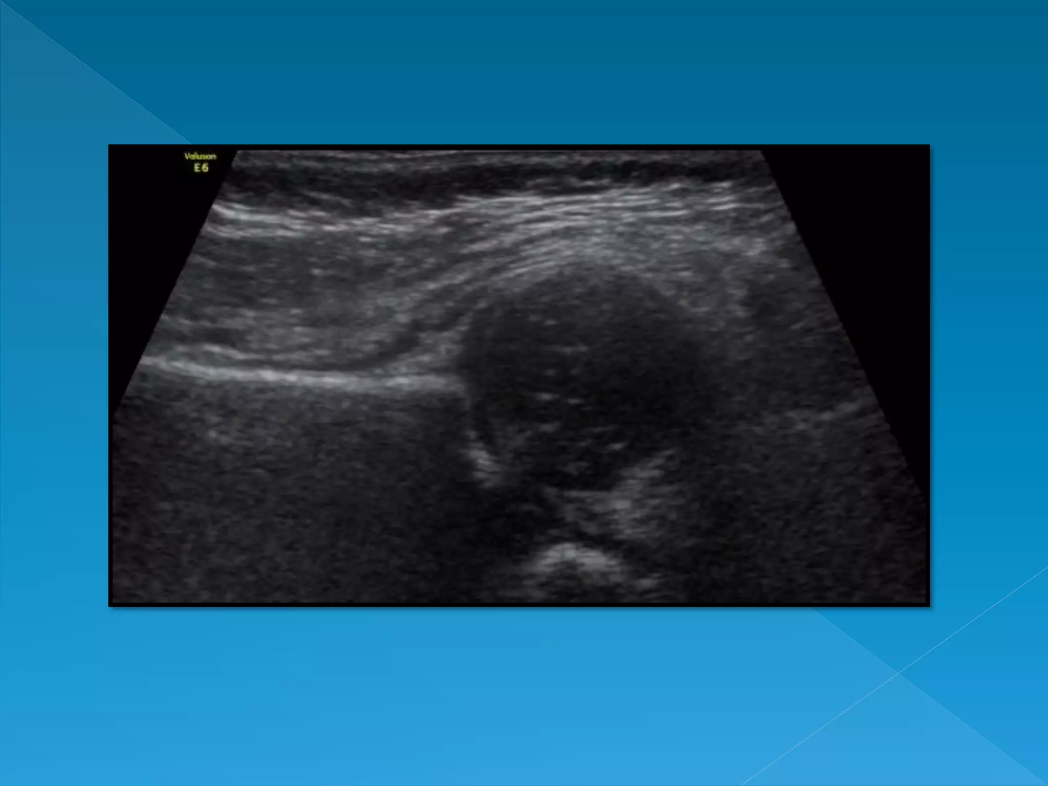 Introduction to msk us normal appearance pdf | PDF