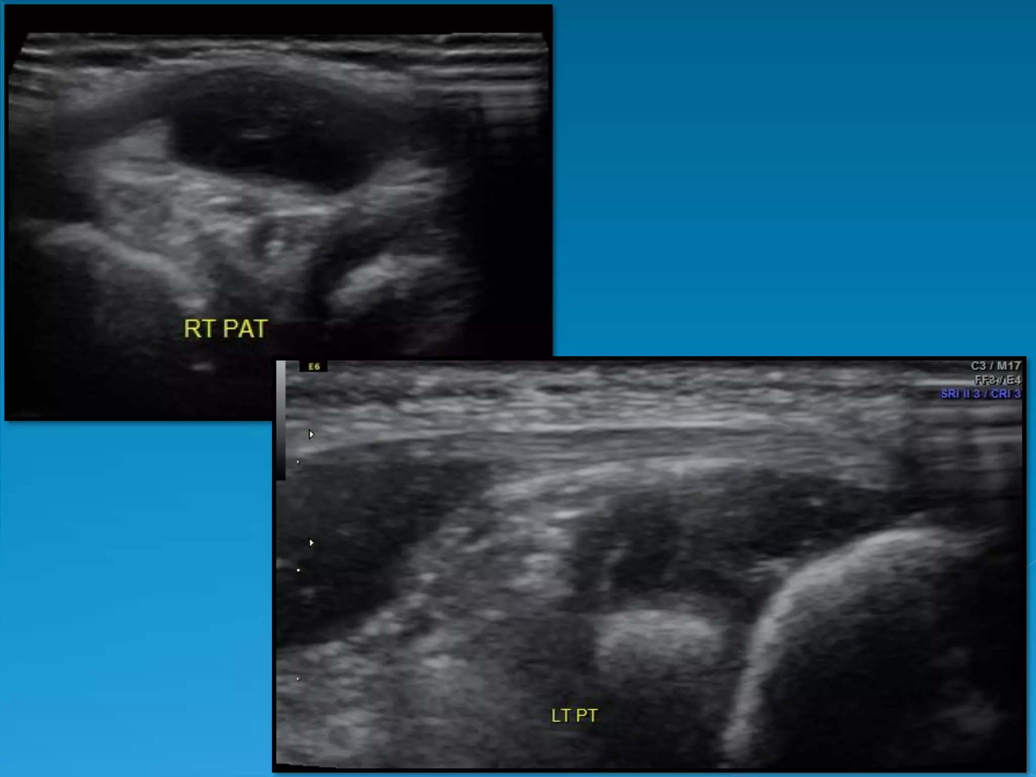 Introduction to msk us normal appearance pdf | PDF