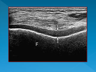 Introduction to msk us normal appearance pdf | PDF