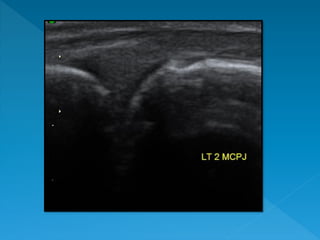 Introduction to msk us normal appearance pdf | PDF