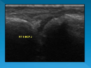 Introduction to msk us normal appearance pdf | PDF