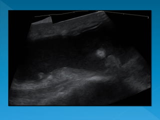 Introduction to msk us normal appearance pdf | PPT