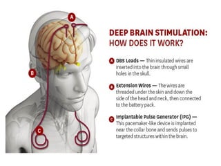 Introduction to Neuroscience and Its Engineering Applications: Neural ...