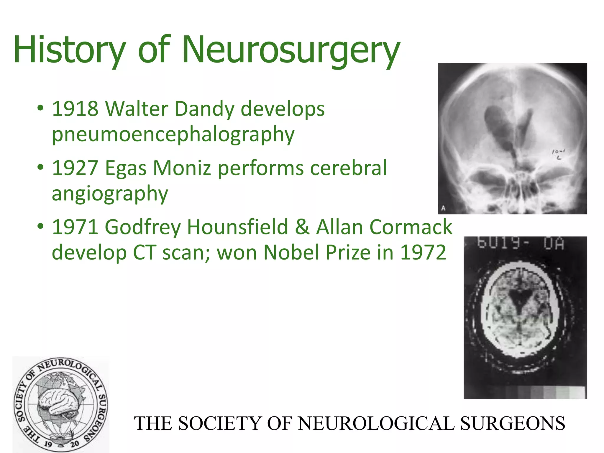 Introduction to Neurosurgery (1).pptx