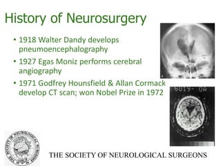 Introduction to Neurosurgery (1).pptx