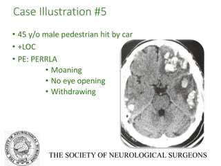 Introduction to Neurosurgical Subspecialties Trauma and Critical Care ...