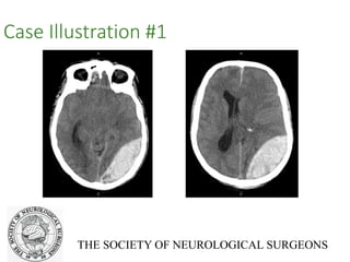 Introduction to Neurosurgical Subspecialties Trauma and Critical Care ...