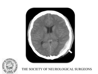 Introduction to Neurosurgical Subspecialties Trauma and Critical Care ...