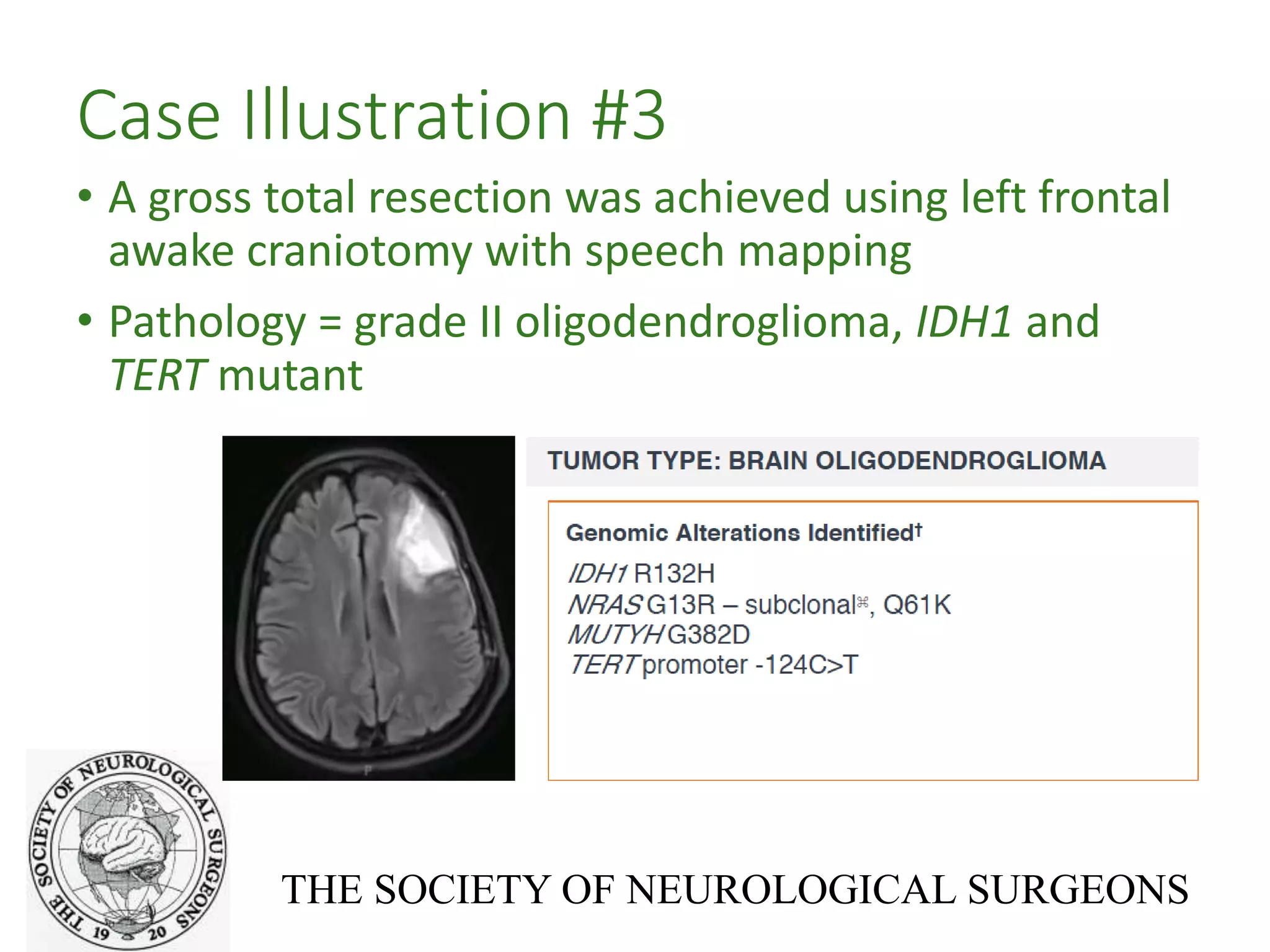 Introduction to Neurosurgical Subspecialties Tumor and Skull Base Neurosurgery.pptx