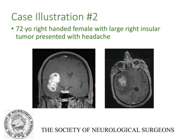 Introduction to Neurosurgical Subspecialties Tumor and Skull Base Neurosurgery.pptx