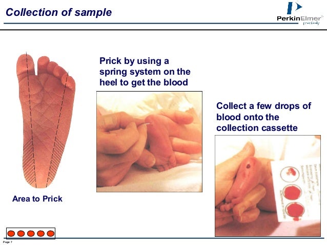 Introduction to new born screening