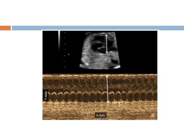 Introduction to obs. ultrasound | PPTX