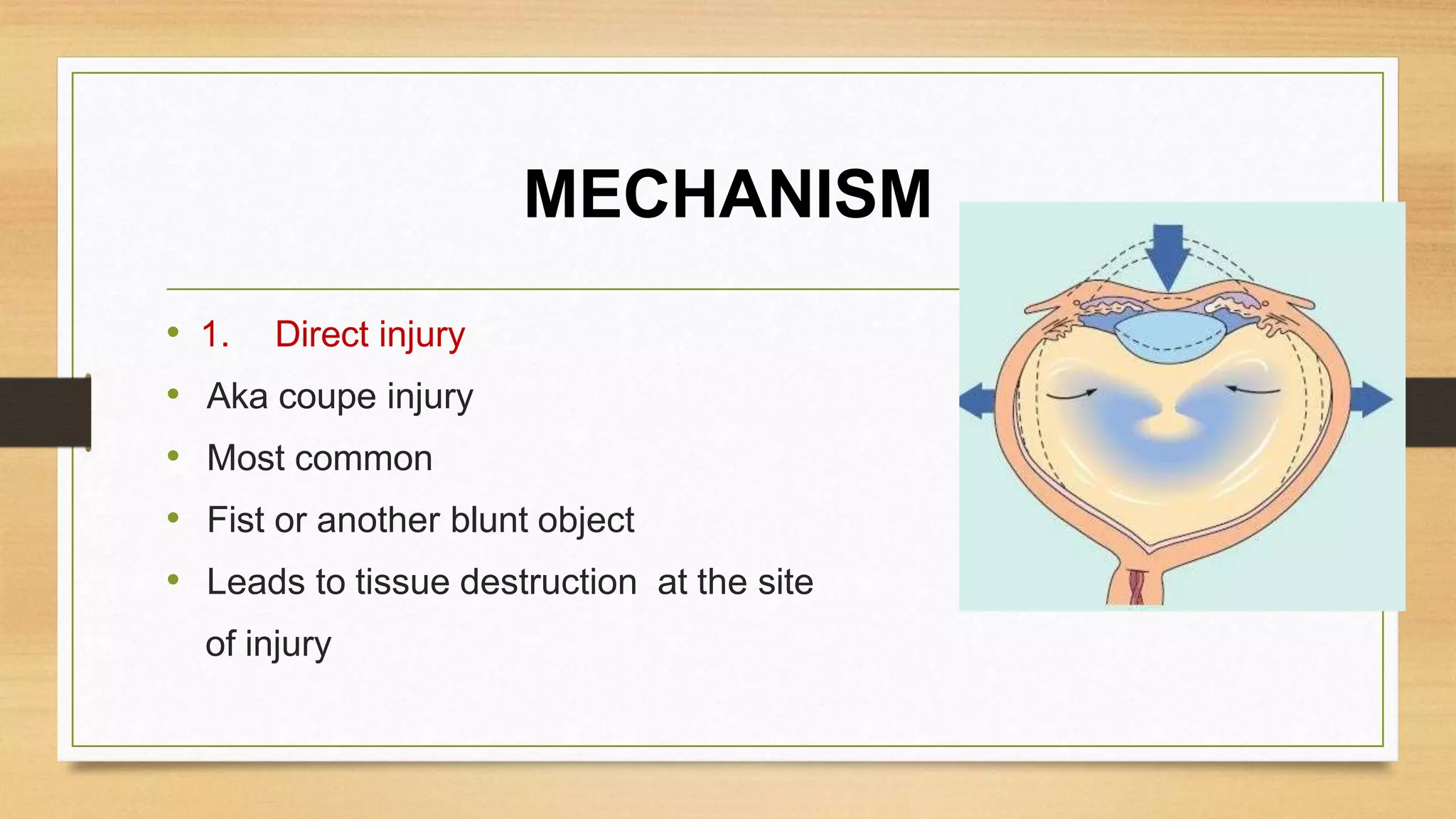 introduction to Ocular trauma.pptx