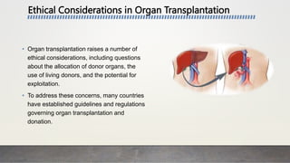introduction to organ transplantation.pptx