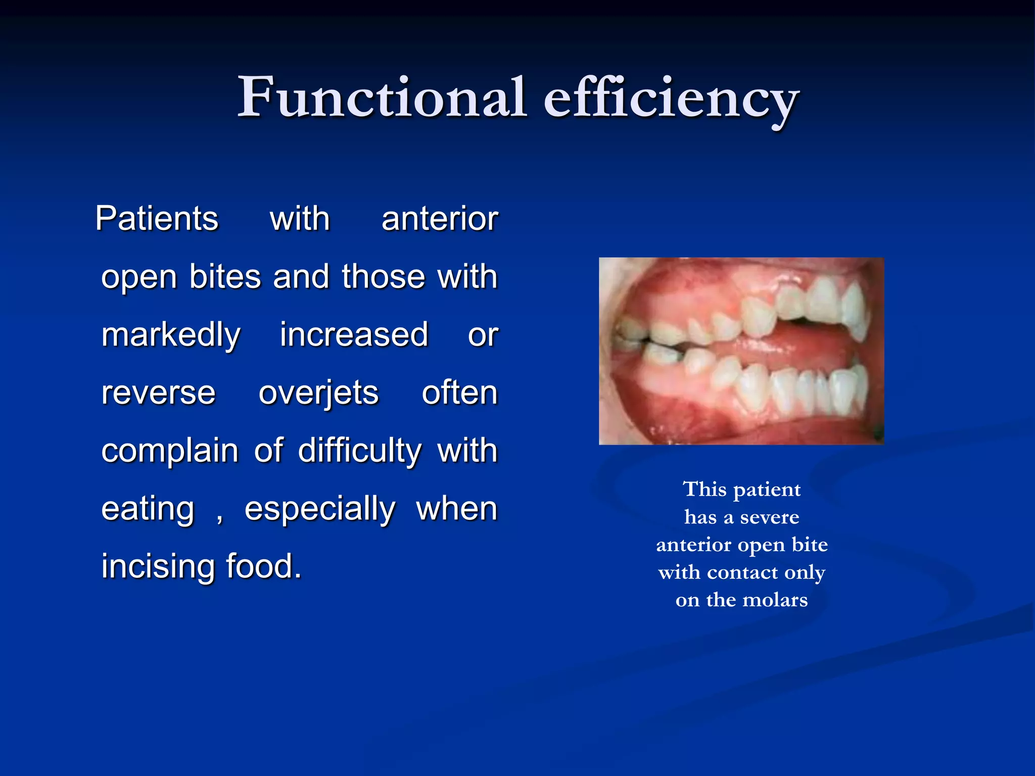 Introduction to orthodontics | PPT