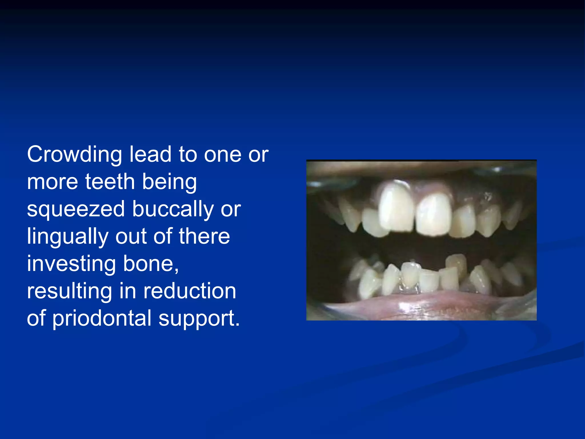 Introduction to orthodontics | PPT