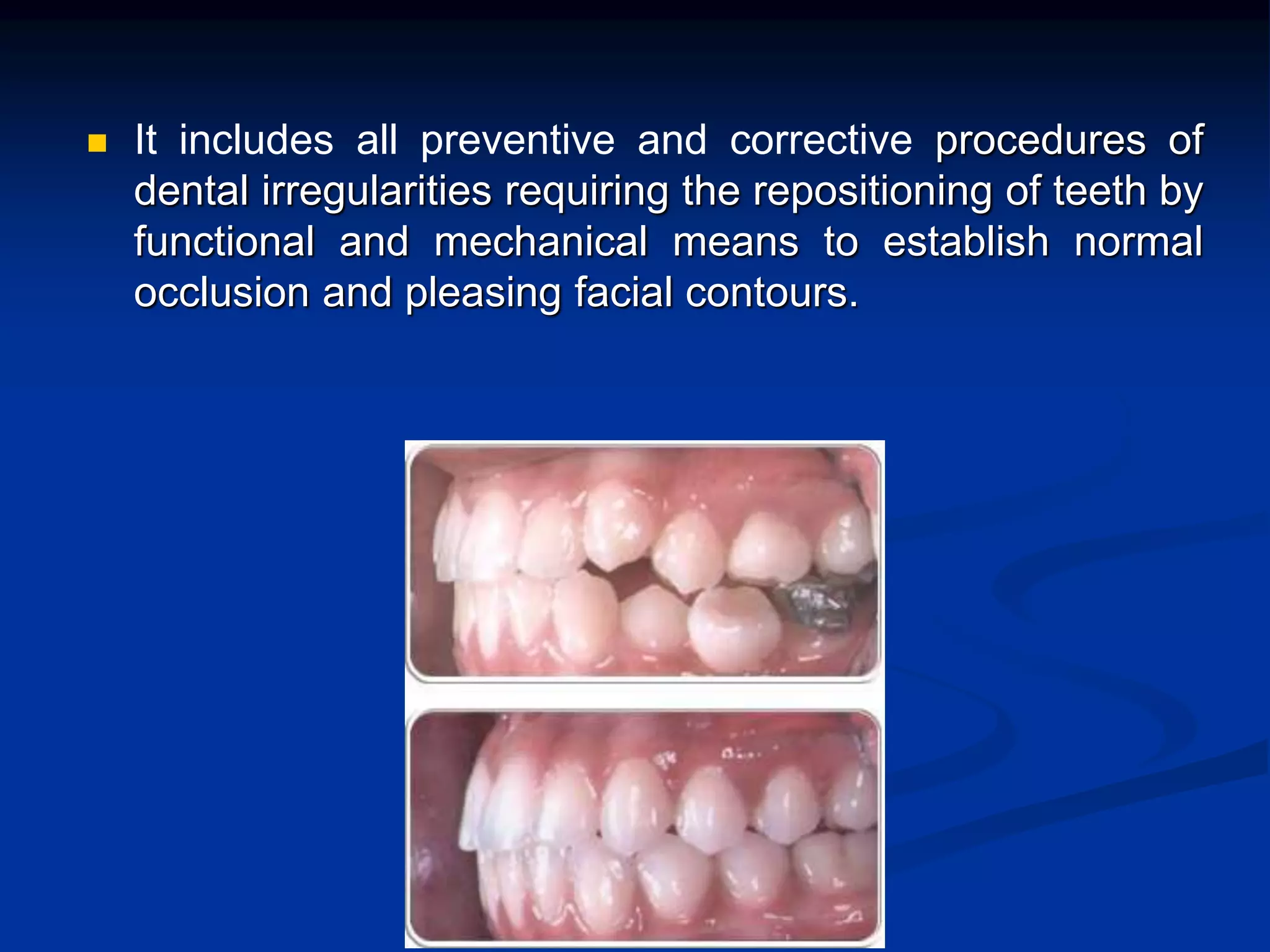 Introduction to orthodontics | PPT