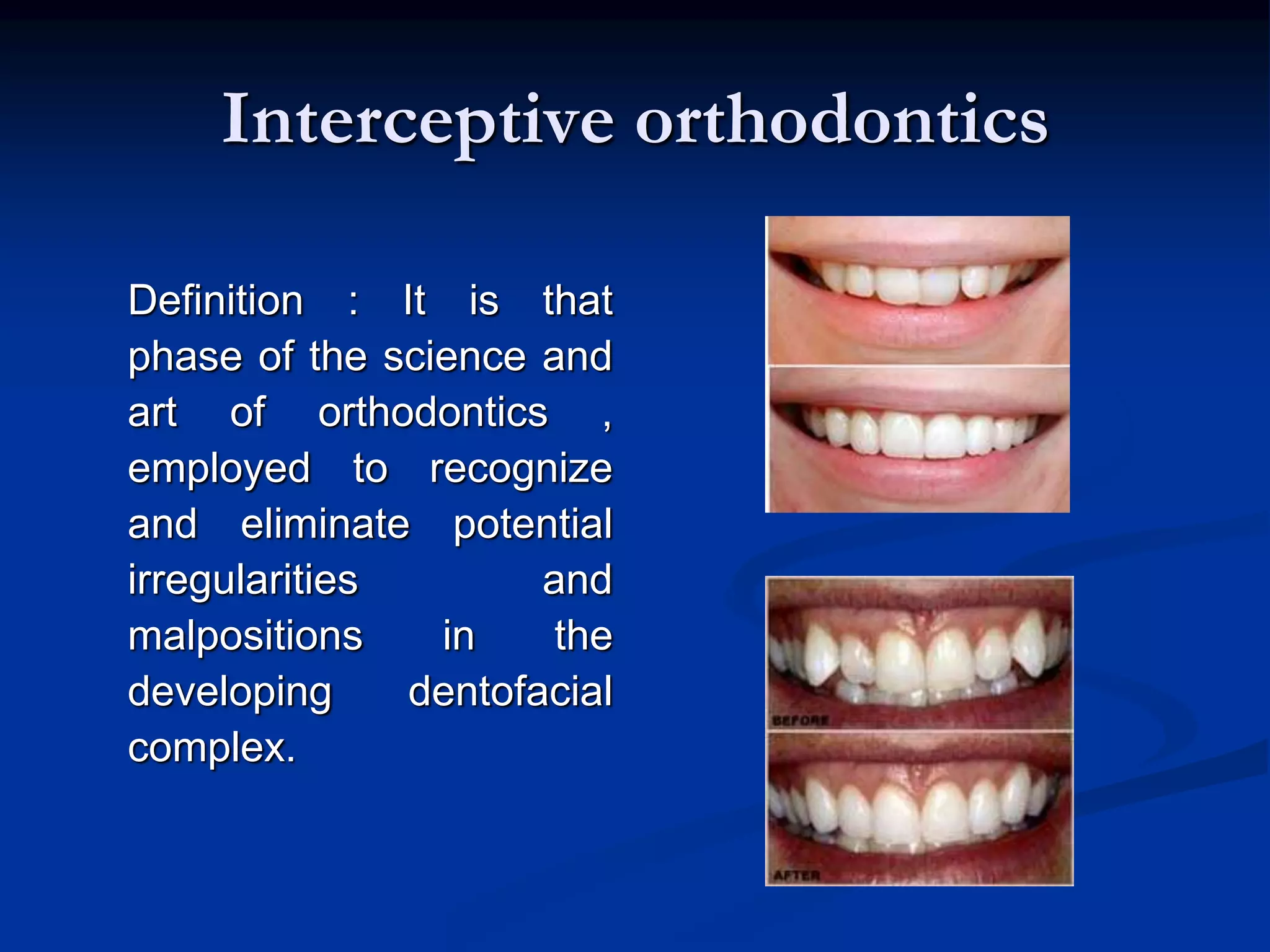 Introduction to orthodontics | PPT