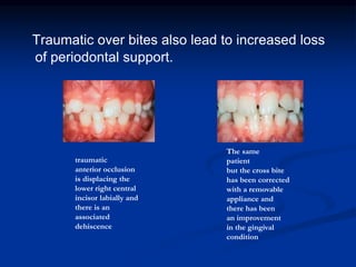 Introduction to orthodontics | PPT