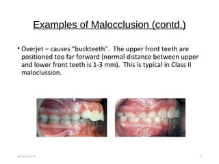 Introduction to Orthodontics Dr.Saurabh Goel | PPT