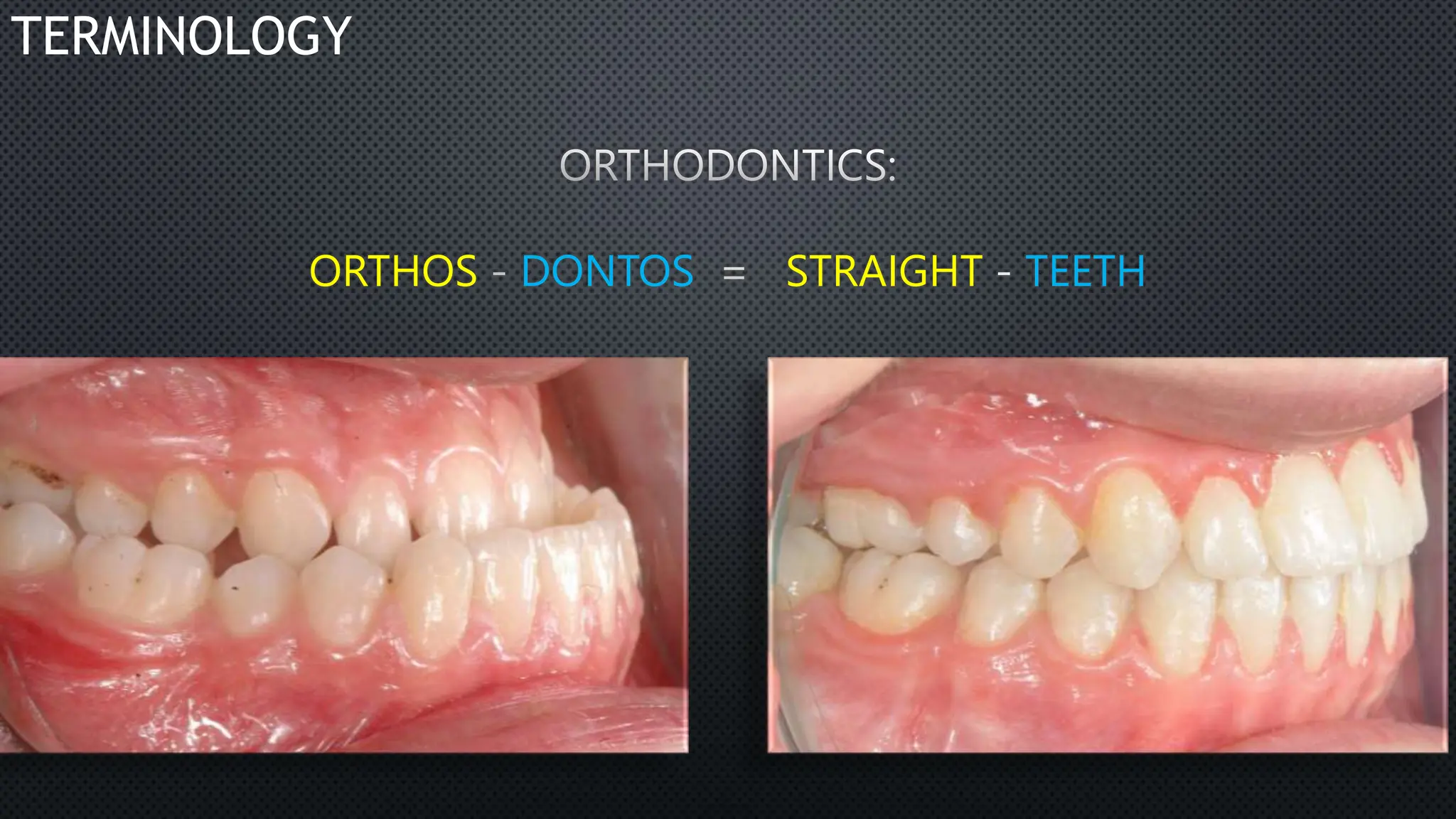 Introduction to orthodontics and terminology of growth development 3 ...