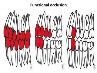 Introduction to Orthodontics (DTH 315).pptx