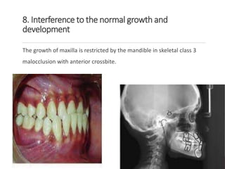 Introduction to orthodontics | PPTX