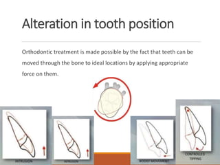 Introduction to orthodontics | PPTX