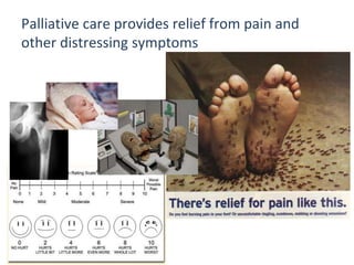 Introduction to palliative care | PPTX