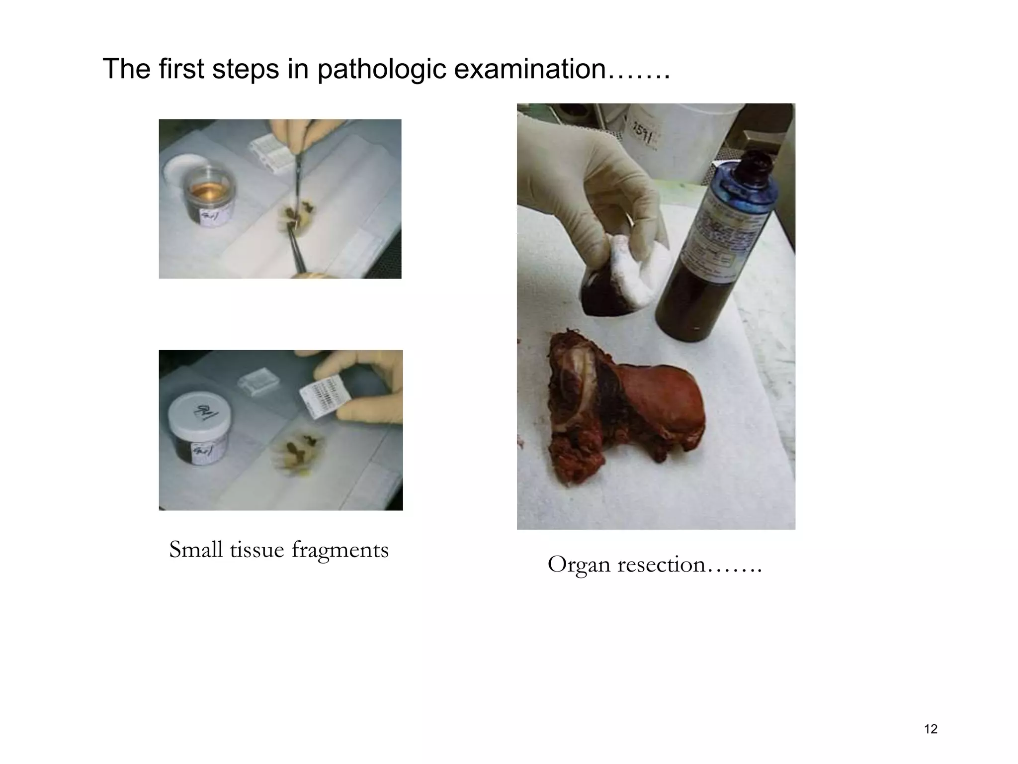 Introduction to pathology | PPT