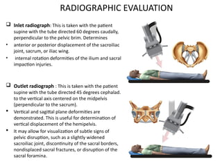 INTRODUCTION TO PELVIC INJURIES - In brief pptx | PPTX