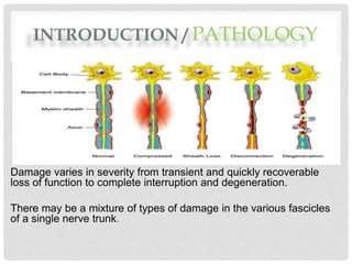Introduction to periphral nervous sys | PPT