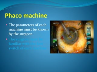 Introduction to phaco operation | PPSX