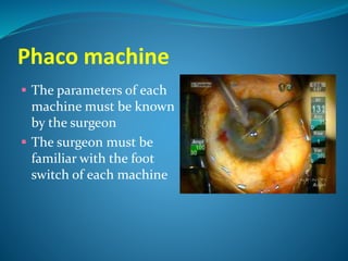 Introduction to phaco operation | PPSX