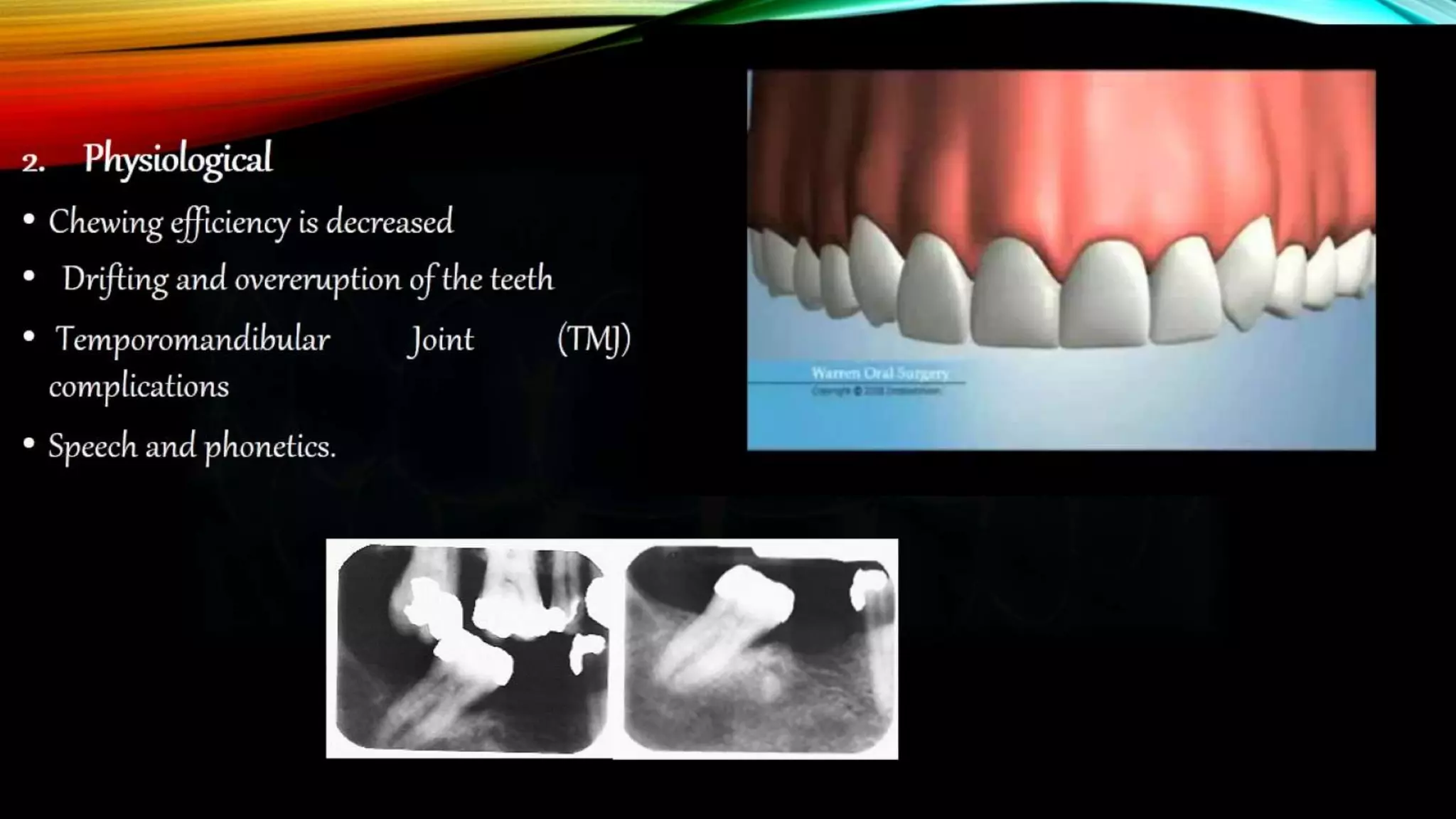 Introduction to prosthodontics | PPTX