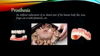 Introduction to prosthodontics | PPTX