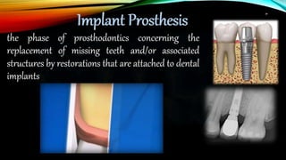 Introduction to prosthodontics | PPTX