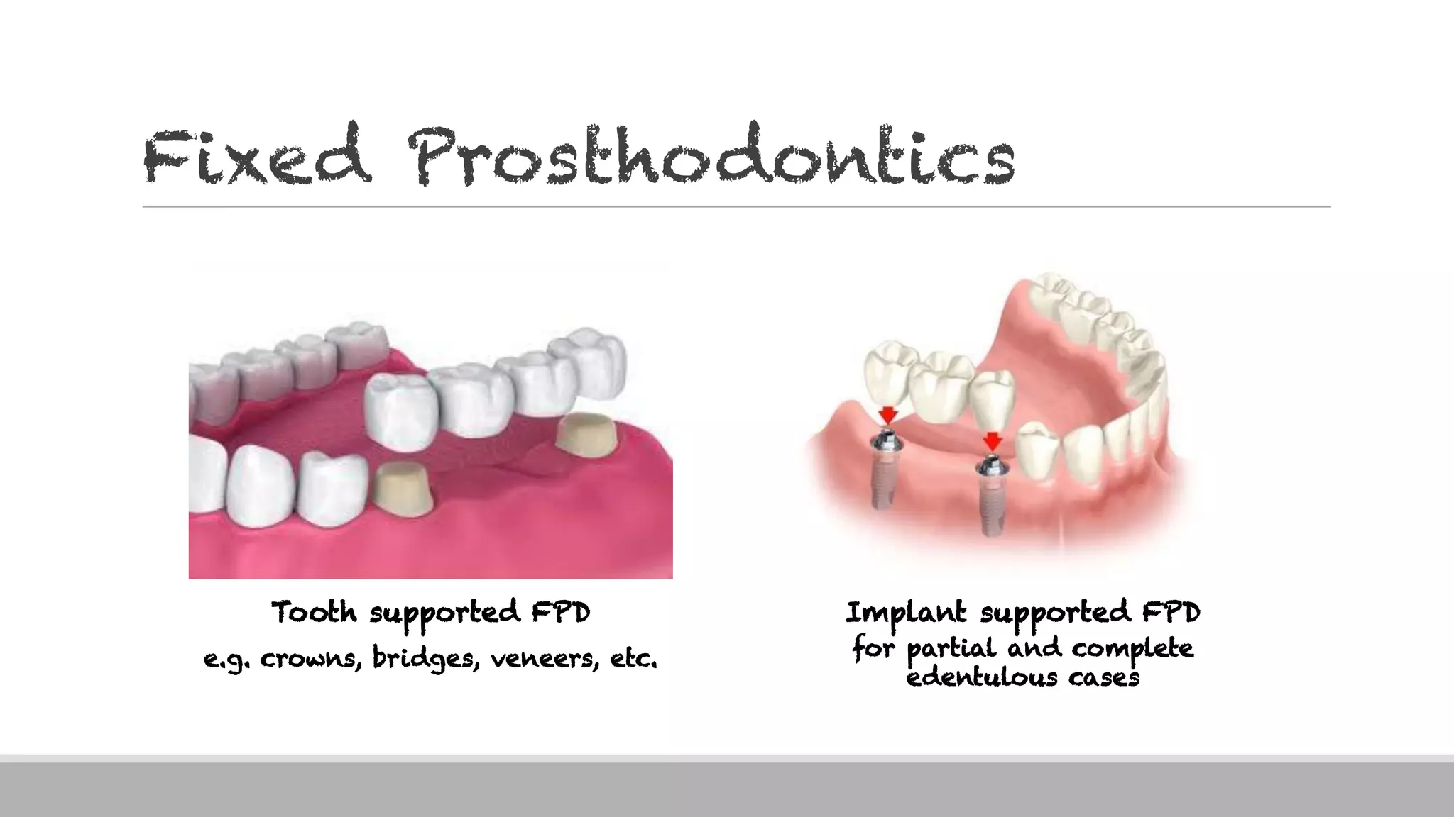 INTRODUCTION TO PROSTHODONTICS AND COMPLETE DENTURES | PDF