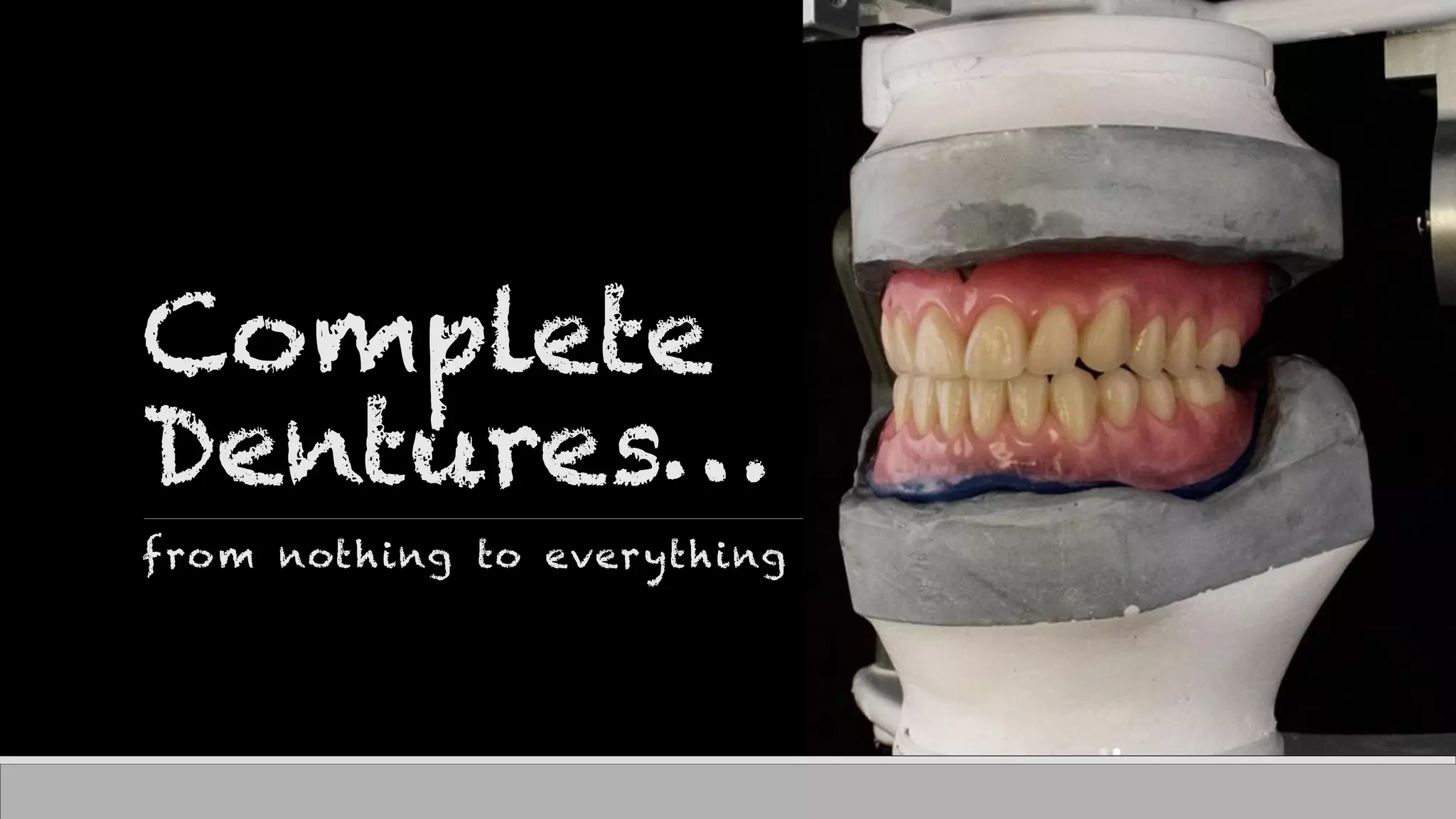 INTRODUCTION TO PROSTHODONTICS AND COMPLETE DENTURES | PDF