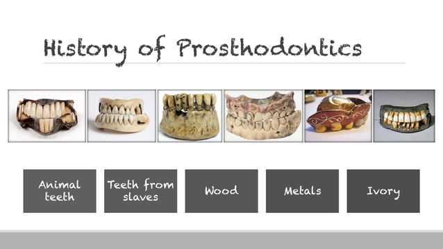 INTRODUCTION TO PROSTHODONTICS AND COMPLETE DENTURES | PDF | Oral care ...