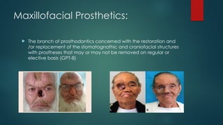 Introduction to Prosthodontics.ppt dentistryx | PPTX