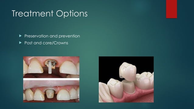 Introduction to Prosthodontics.ppt dentistryx | PPTX