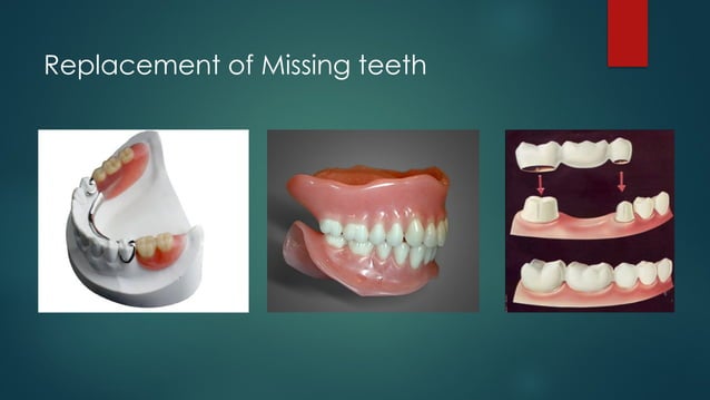 Introduction to Prosthodontics.ppt dentistryx | PPTX
